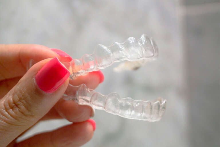 Retenedor dental de ortodoncia ¿Para qué sirve?