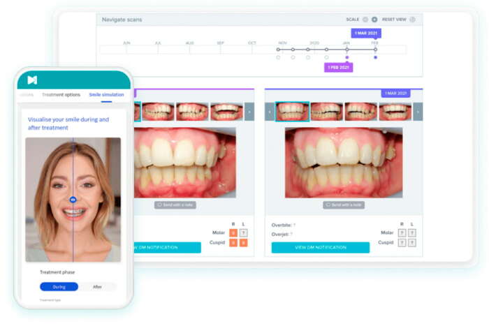 Dental Monitoring ¿para qué sirve este software dental?
