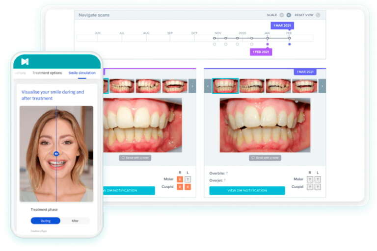 Dental Monitoring ¿para qué sirve este software dental?