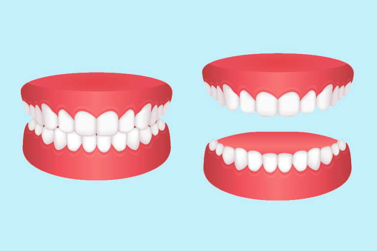 ¿Cómo tiene que ser la mordida perfecta? | Clínicas Den